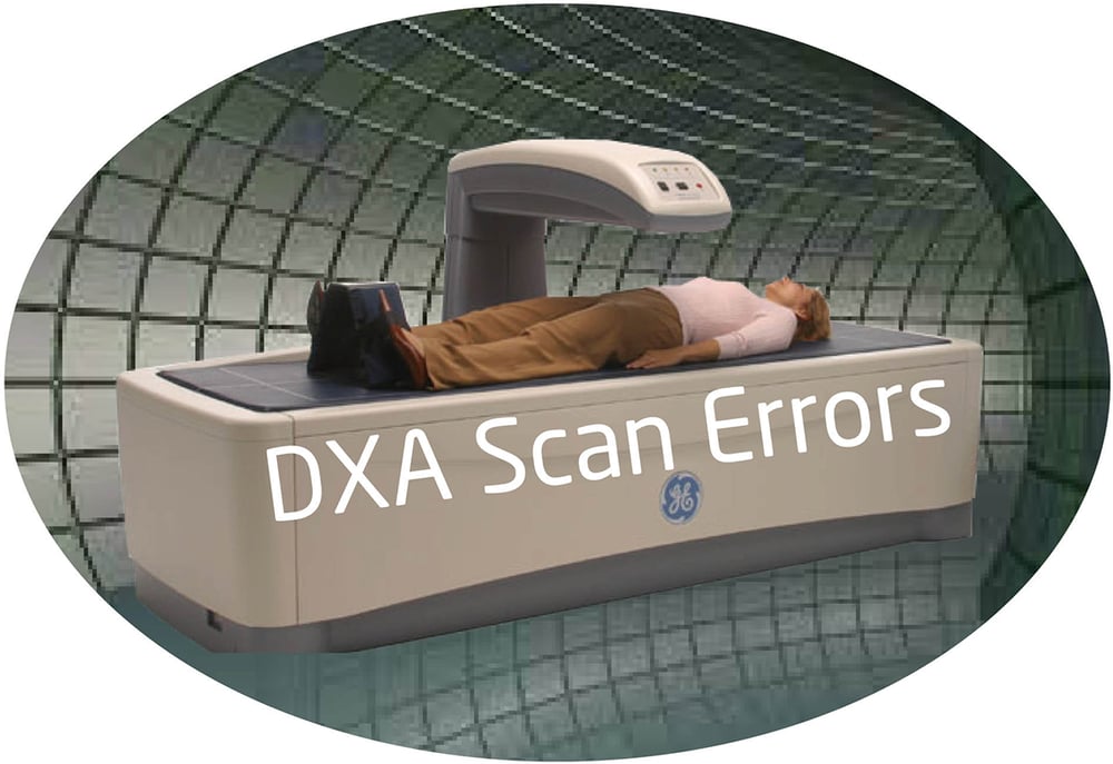 The Sources of Common DXA Scan Errors